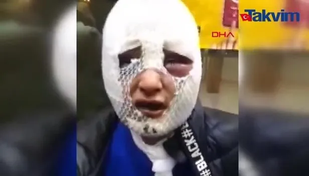 Hatay’da korkunç olay! Evini bastığı eski sözlüsüne bakın ne yaptı ... Hatay’da korkunç olay! Evini bastığı eski sözlüsüne bakın ne yaptı ...